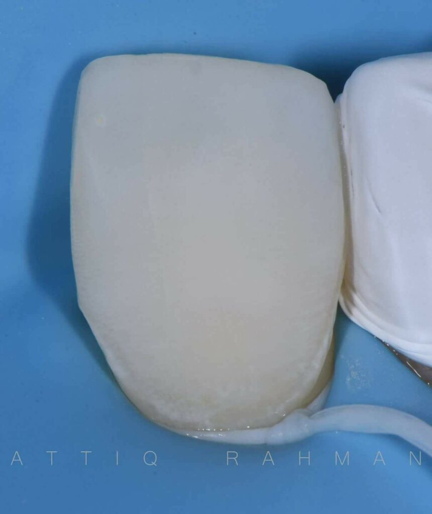 Anterior Masterclass – Precision Academy